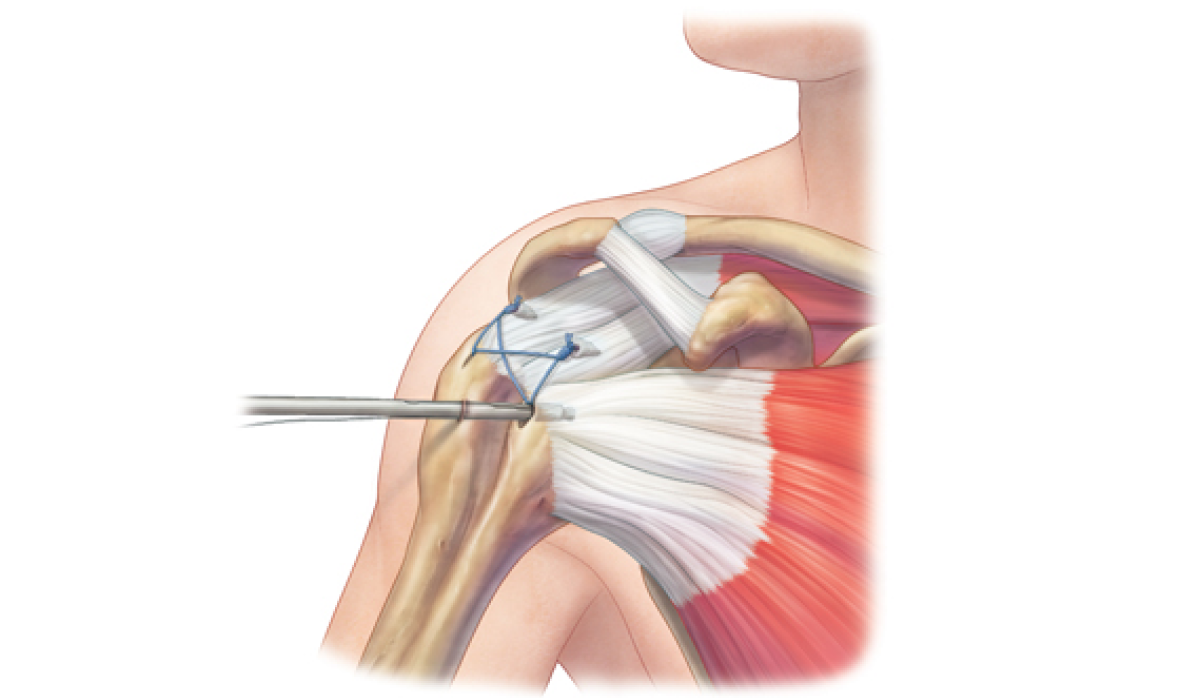 Wiltse Memorial Hospital
